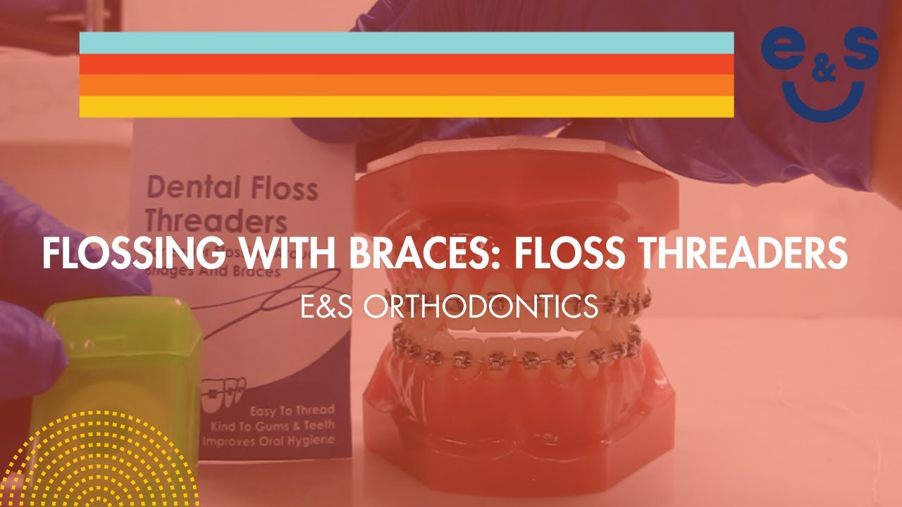 Flossing with Braces: Dental Floss Threaders - YouTube