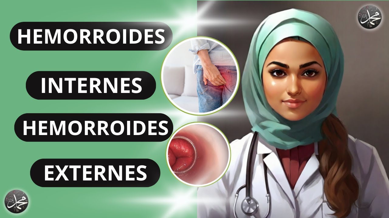 Solutions et Remedes contre les Hemorroides Internes Et Externes @muslimuslim368 #1 - YouTube