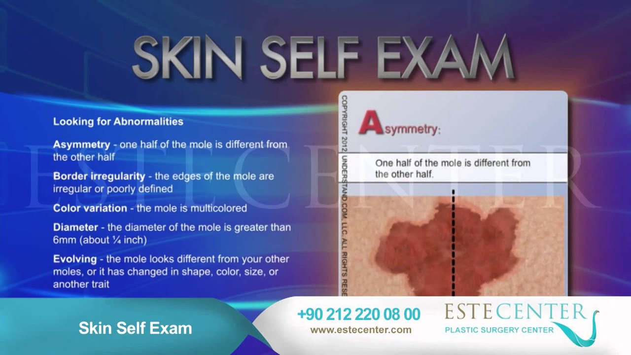 Skin Self Exam - YouTube