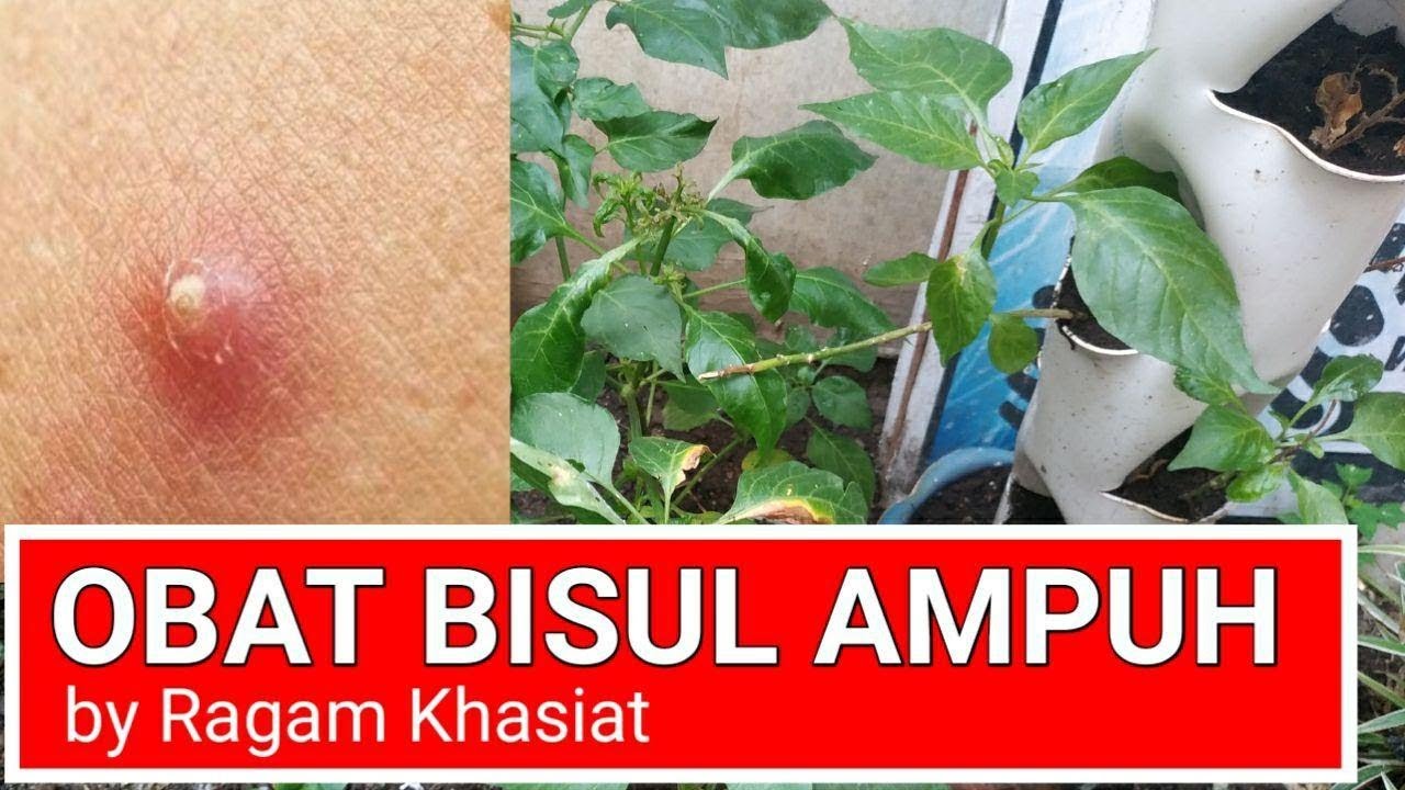 BANYAK BELUM TAU !! Obat Bisul Paling Ampuh untuk kita | Cara mengobati ...
