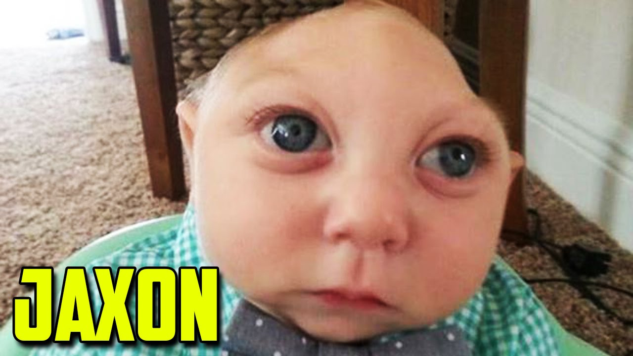 La Increíble Historia De Jaxon | Sobrevivio A Lisencefalia? - YouTube