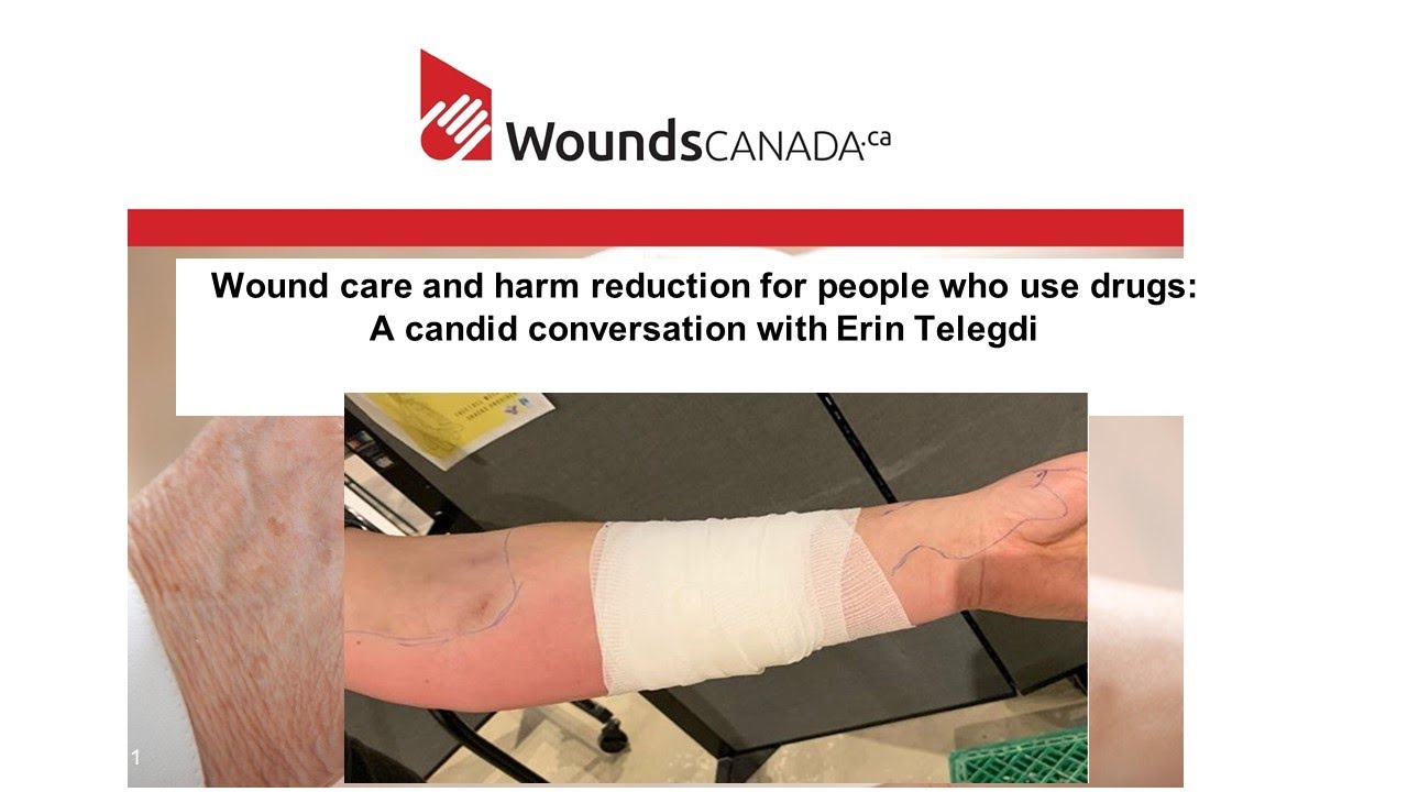Webinar Presentation: Wound Care and Harm Reduction in People Who Use ...