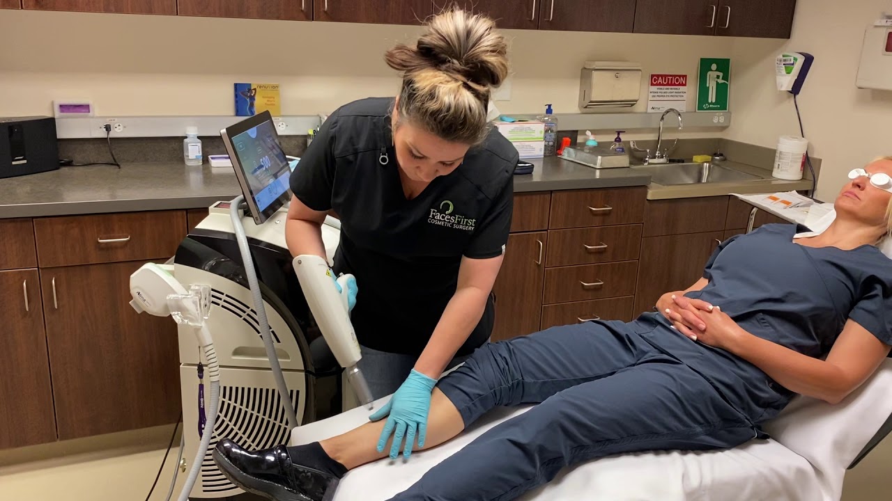 Leg Vien Treatment with FacesFirst! - YouTube