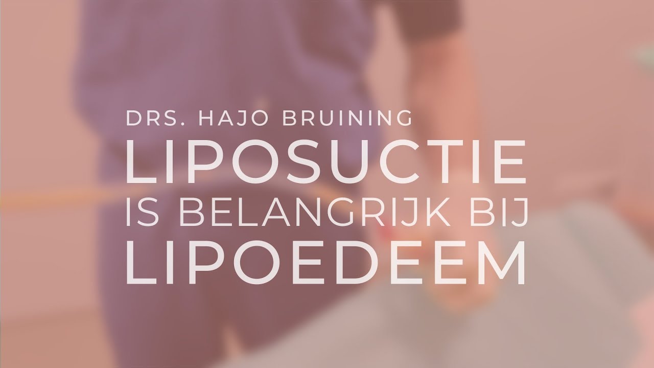 Waarom is liposuctie bij lipoedeem belangrijk? Lipoedeem-expert Hajo ...