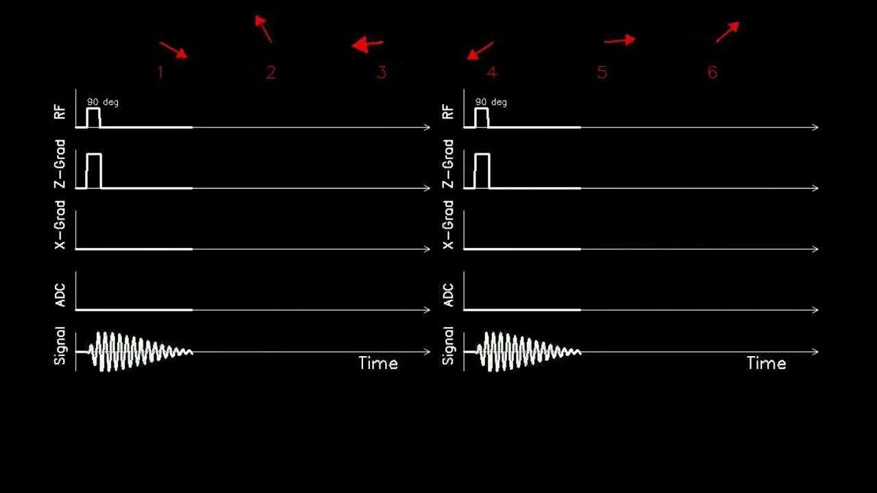 MRI: Physics and Image Creation - Frequency Encoding 1D Example (Part ...