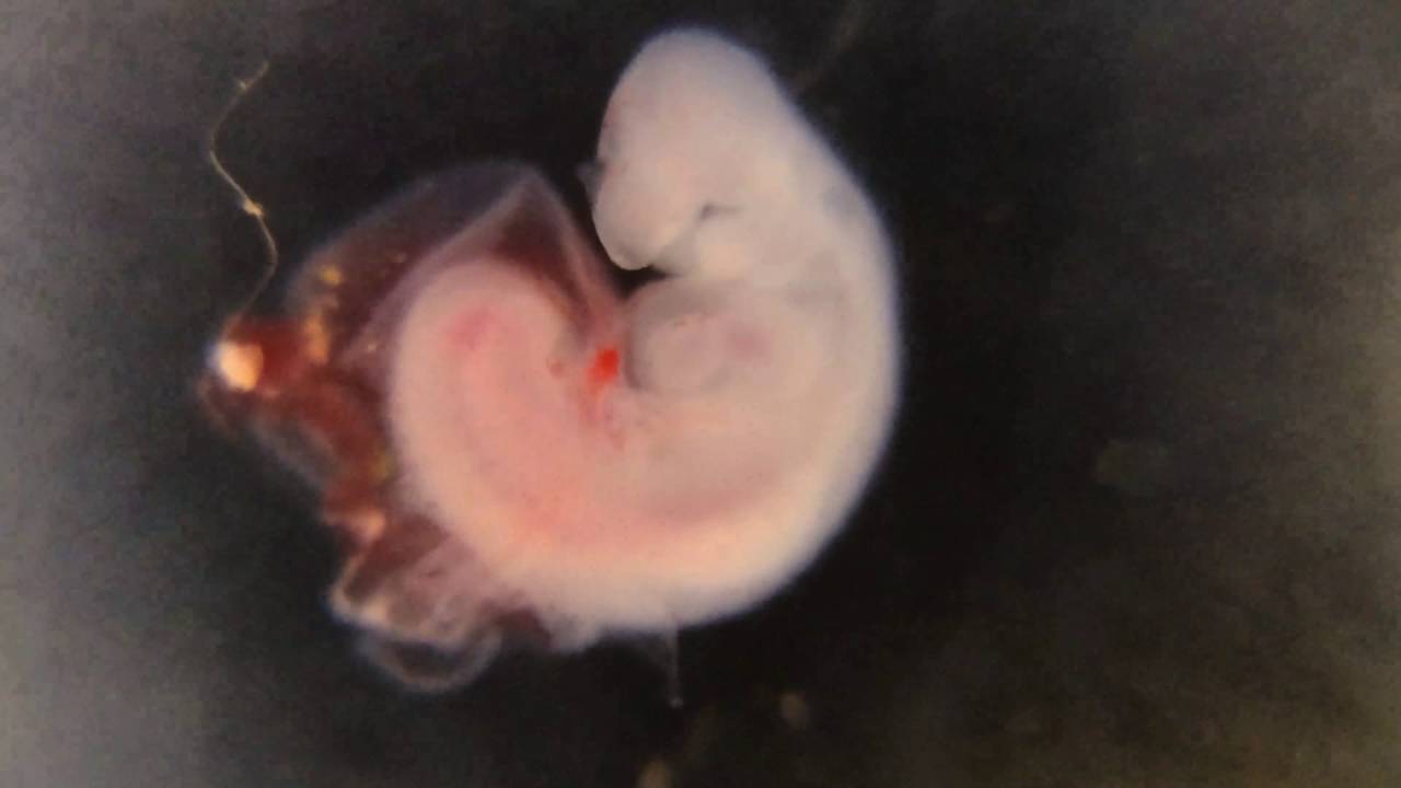 Bat embryo heart - Erophylla Sezekorni - YouTube