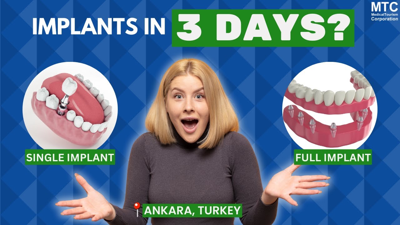 Dental Implants in Turkey: All You Need To Know in Under 3 Minutes ...