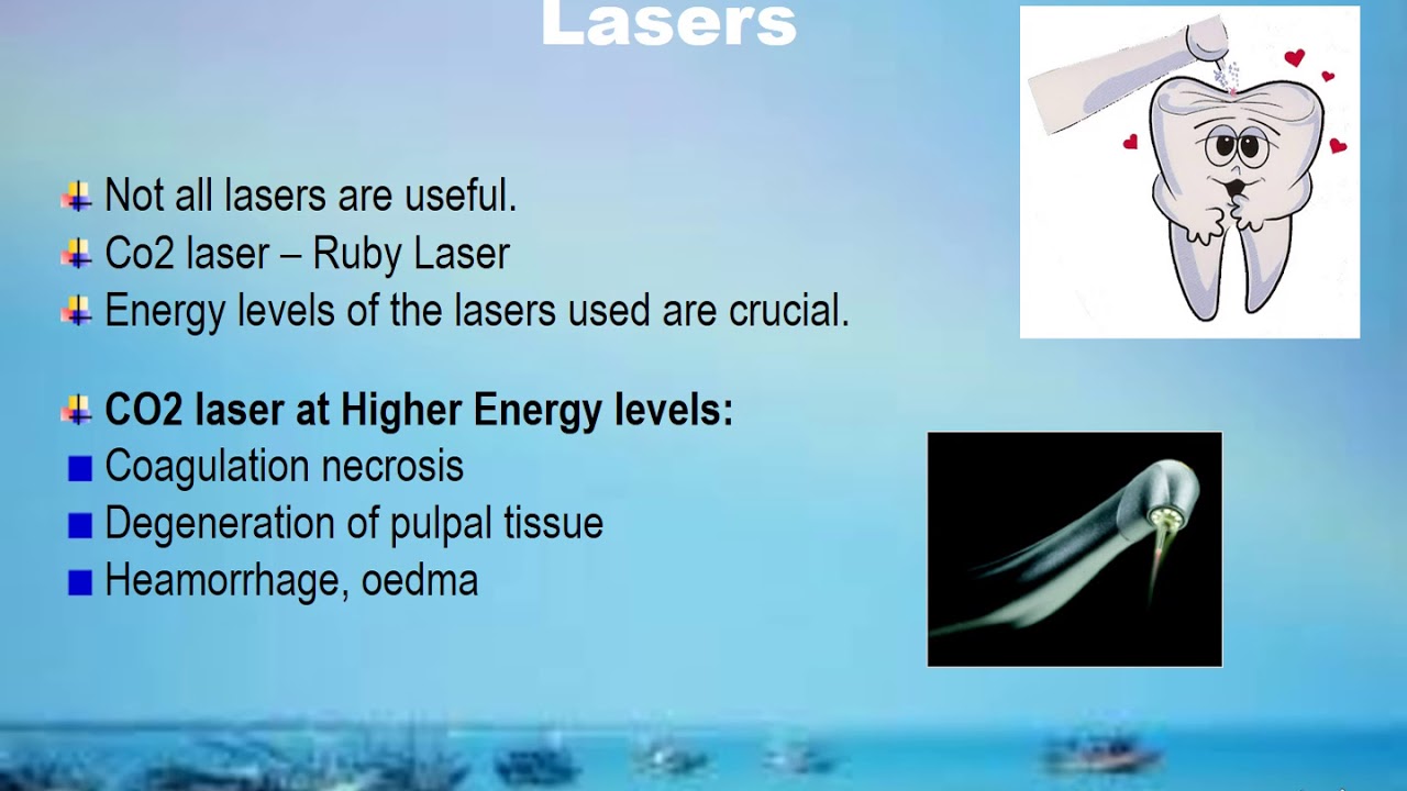 Pulp capping Agents Dr Lakshmi Nidhi mp4 part II - YouTube