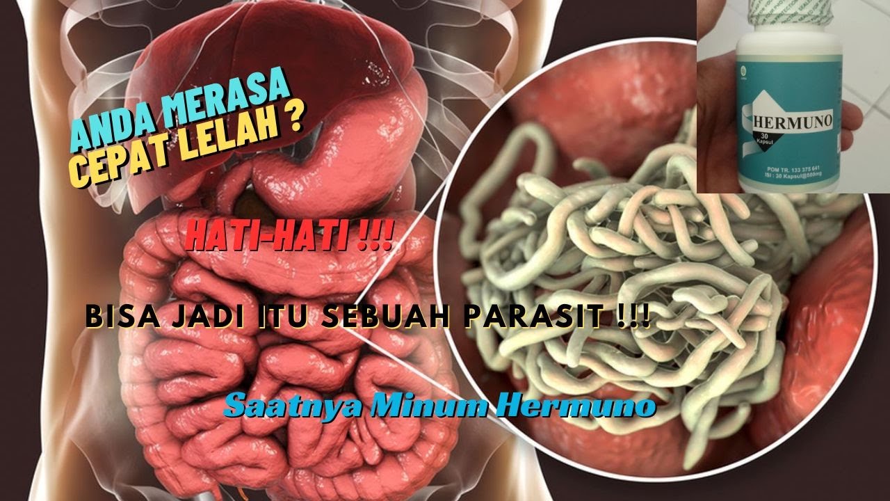 Hermuno Obat Herbal Untuk Mengatasi Parasit Original - YouTube