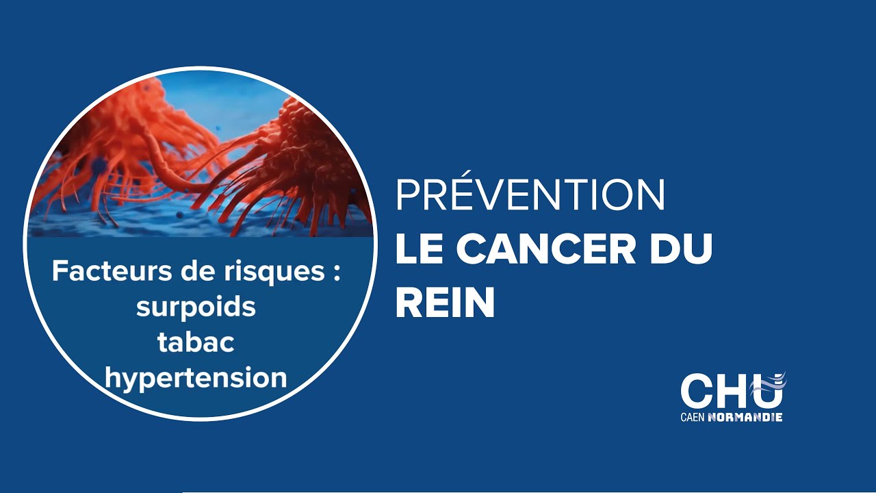 La prise en charge du cancer du rein au CHU Caen Normandie - YouTube