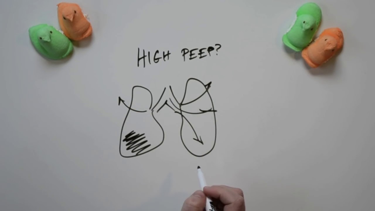 PEEP VENTILATOR CONCEPT YouTube peep-ventilator-concept-youtube