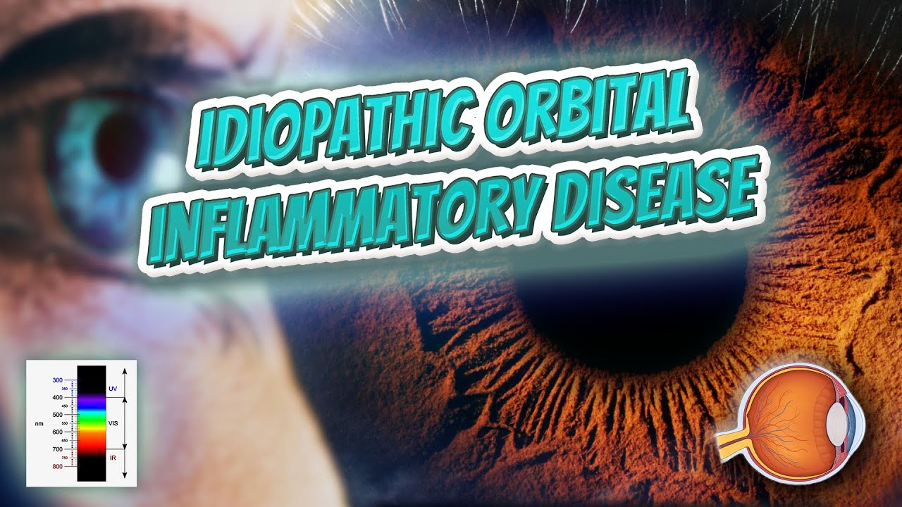 Idiopathic orbital inflammatory disease (Your EYEBALLS) 👁️👁️💉😳💊🔊💯 - YouTube