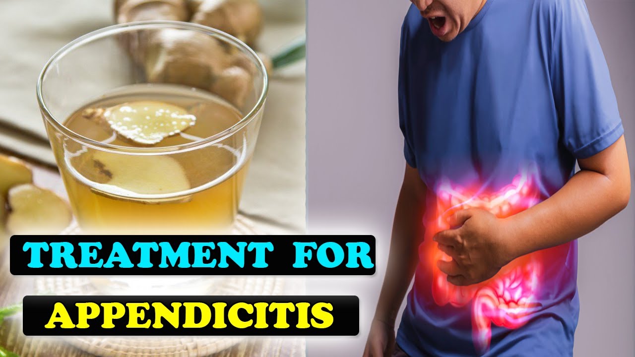 How To Get Rid Of Appendicitis Naturally Without Surgery - YouTube