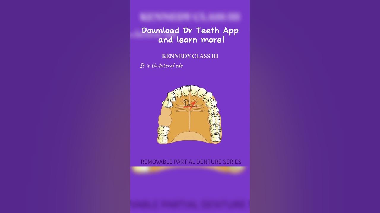 Kennedy's Classification Made Easy! - YouTube