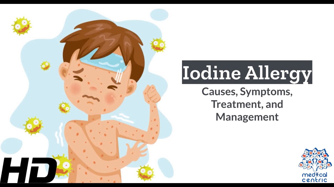 Iodine Allergy Unveiled: Causes, Symptoms, and Solutions - YouTube