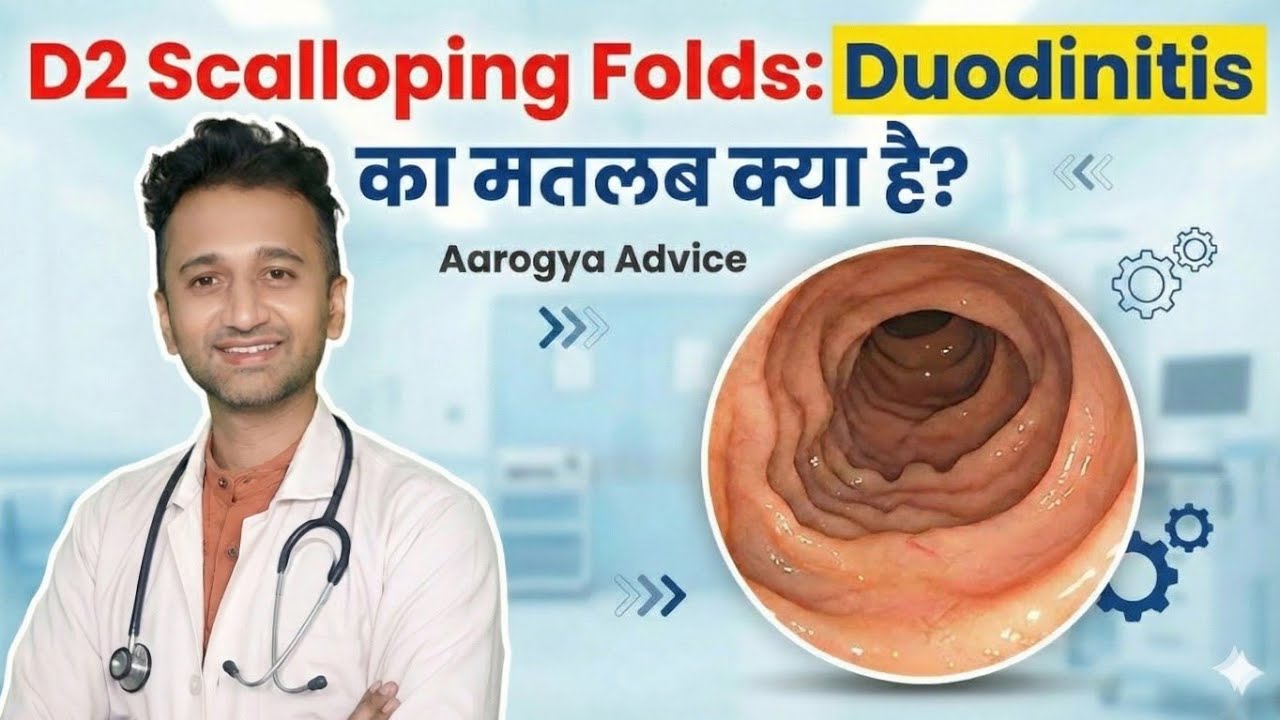 Duodinitis Warning Signs: D2 Scalloping Folds का मतलब क्या है? - YouTube