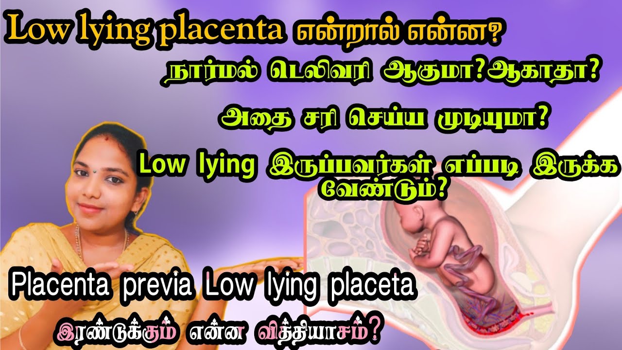 உங்களுக்கு Low lying placenta இருக்கா/what low lying placenta/nanju ...