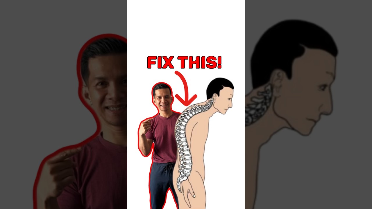 Kyphosis correction exercises. #kyphosis #posture #postureexercises # ...