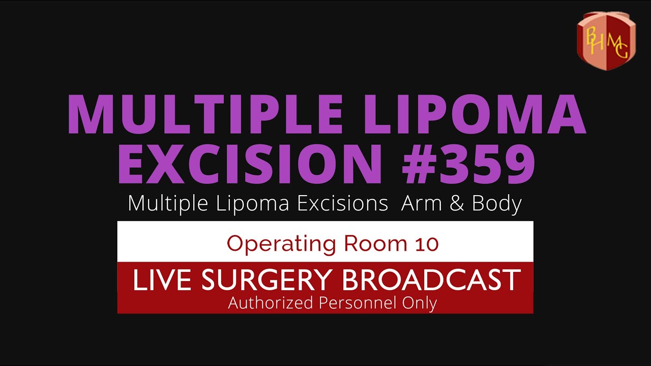How It’s Done! –Multiple Lipoma Excision Of Back(Female, 36, Under ...