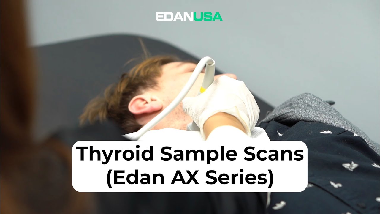 Thyroid Ultrasound Demo Scan (Edan/Acclarix AX Series) - YouTube