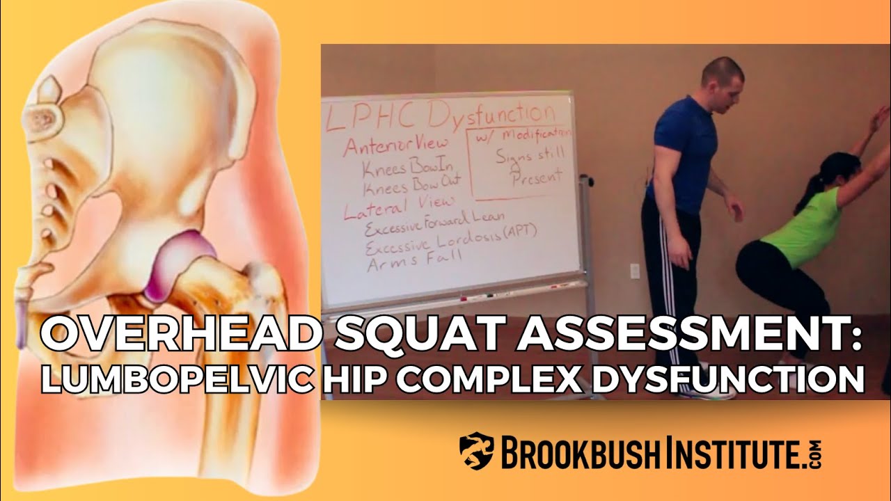 Overhead Squat Assessment: Lumbopelvic Hip Complex Dysfunction - YouTube