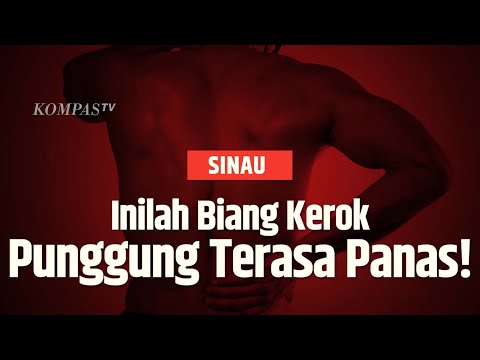 Punggung Sering Terasa Panas Waspada Penyakit Ini|SINAU