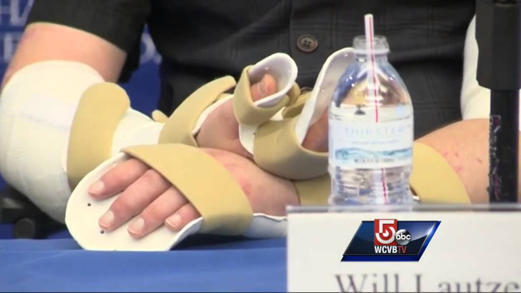 Man gives thanks after double-arm transplant - YouTube