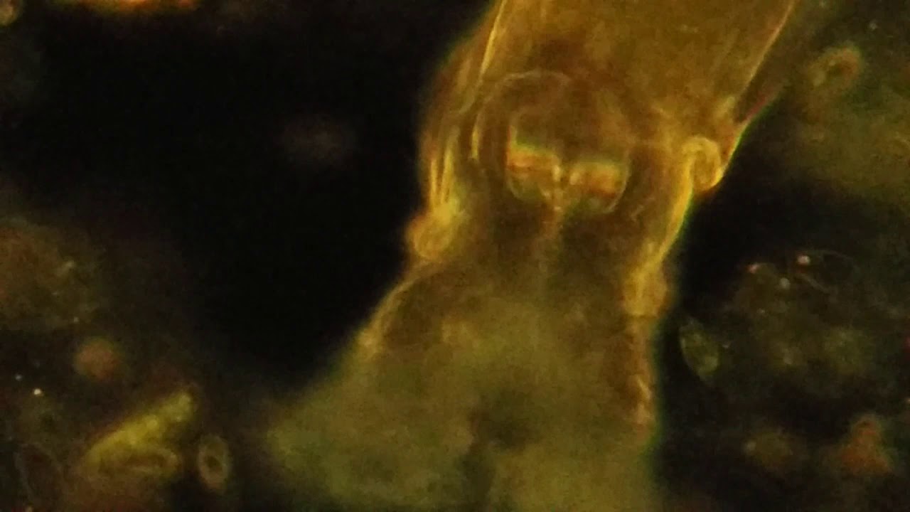 Bdelliod Rotifer Mastax - YouTube