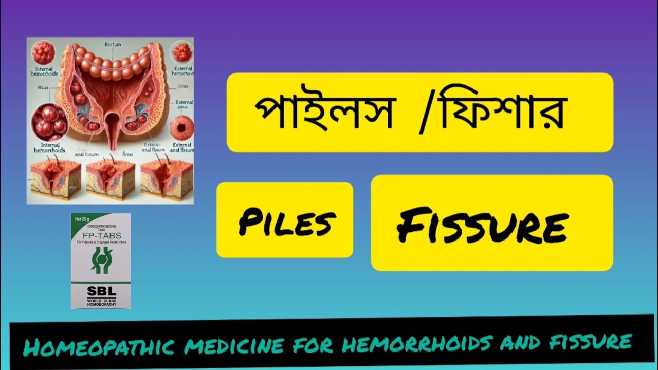 fp tabs|fb tabs sbl|fp tabs tablets|sbl fp tabs review|sbl fp tablets ...