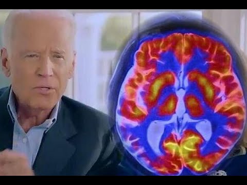 Is this Psychiatrist Analyzing Joe Biden's Brain Scan? - YouTube