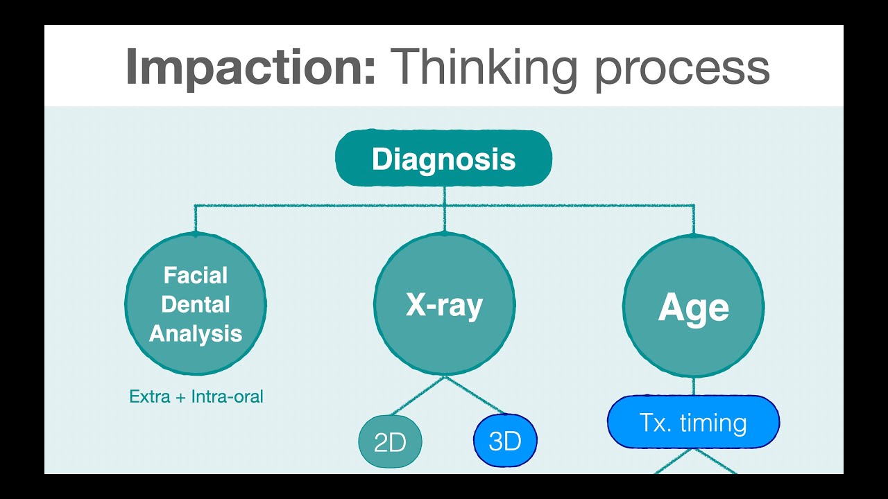 Impaction diagnosis & treatment protocol - Part 1｜【Chris Chang Ortho ...