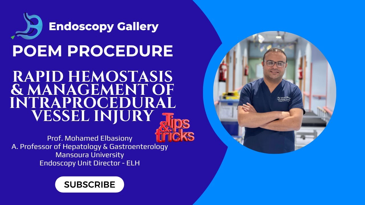 POEM Procedure: Rapid Hemostasis & Management of Intraprocedural Vessel ...