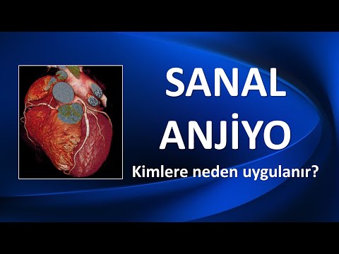 SANAL ANJİYO NEDİR? KİMLERE NEDEN YAPILIR?