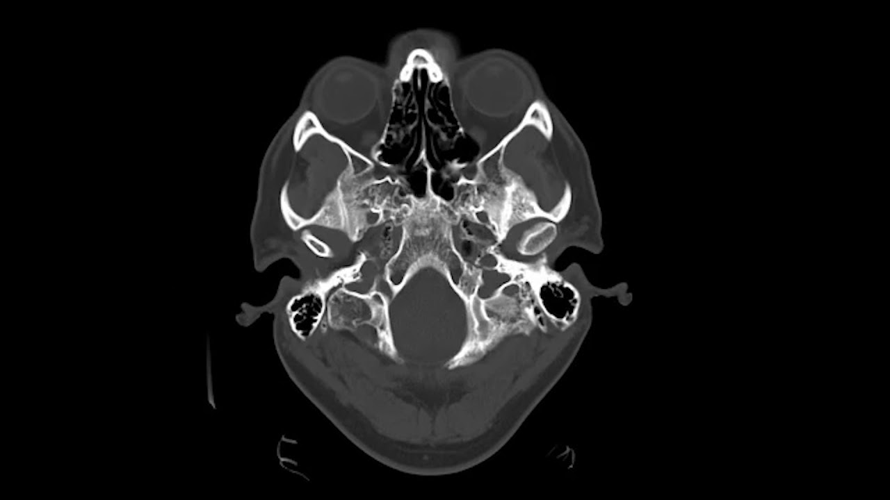 A TOUR OF MY MIND (CT SCAN 2021) - YouTube