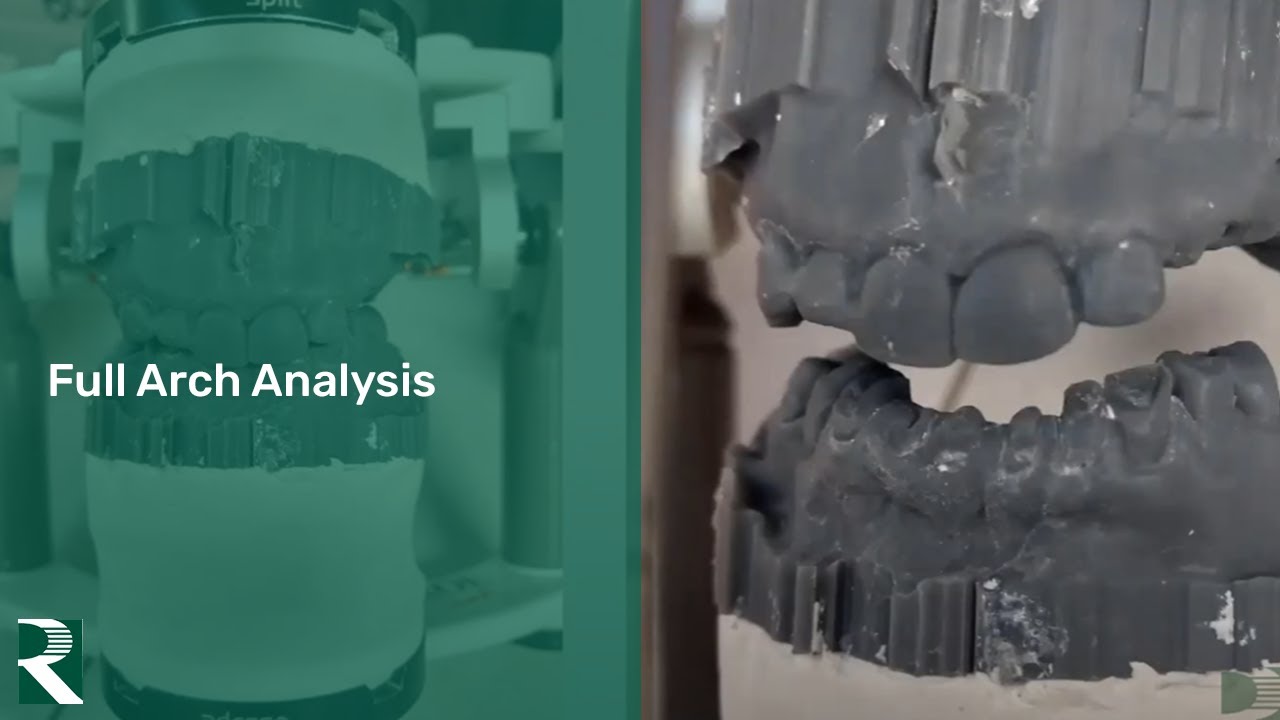 Full Arch Analysis - CHROME Live Webinar Series (5/12) - YouTube