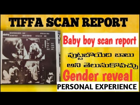 baby boy tiffa scan #report #pregnancy #pregnant #genderreveal #babyboy ...