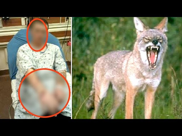 Coyote Attack Human