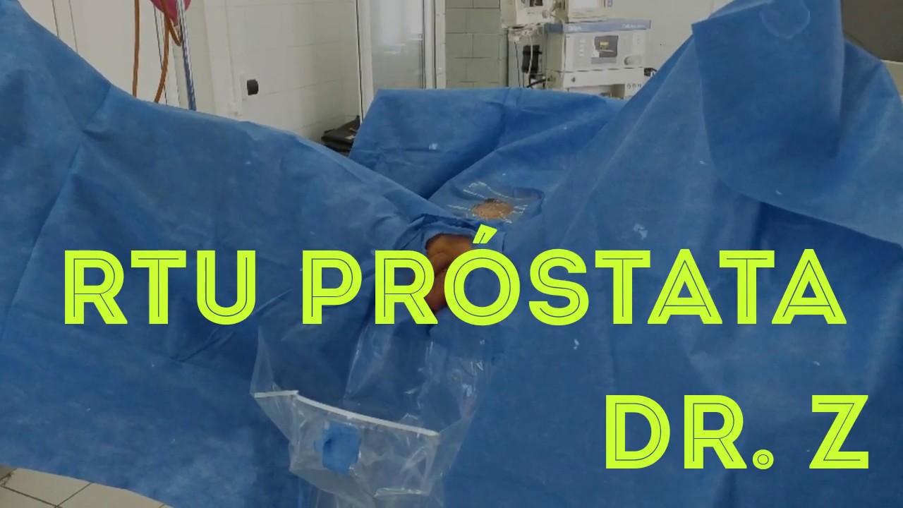 RTU PRÓSTATA..RESECCIÓN transuretral de PRÓSTATA (bipolar) - YouTube