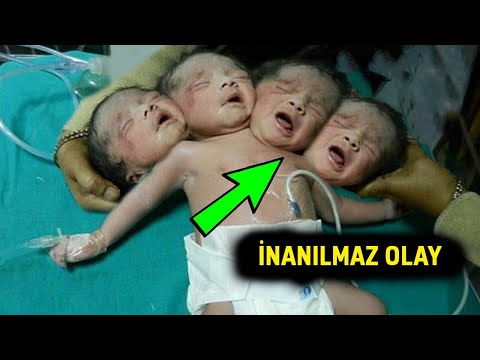 Dünyayı Sarsan Ve Kur’an’ın Hak Olduğuna İşaret Eden Bir Çocuk Doğuran Hintli Kadın!!