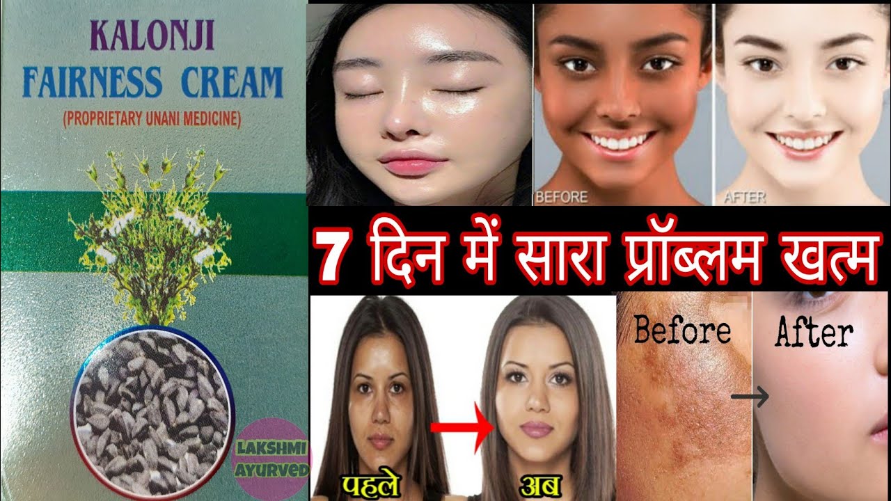 Kalonji Fairness Cream।। Remove Pigmentation।। Unani Medicines ...
