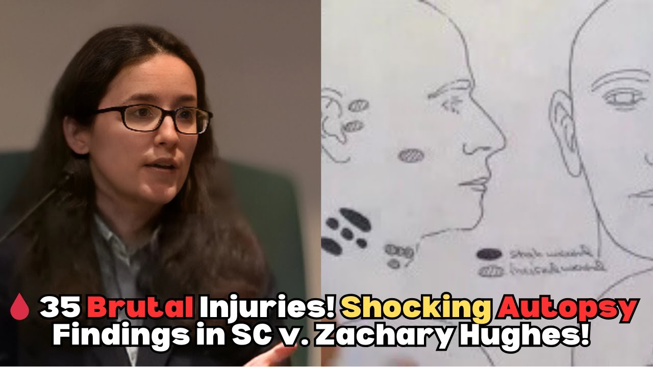 SC v. Zachary Hughes: Medical Examiner Details Brutal Injuries in ...
