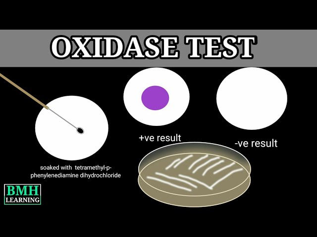 Oxidase Test VetBact