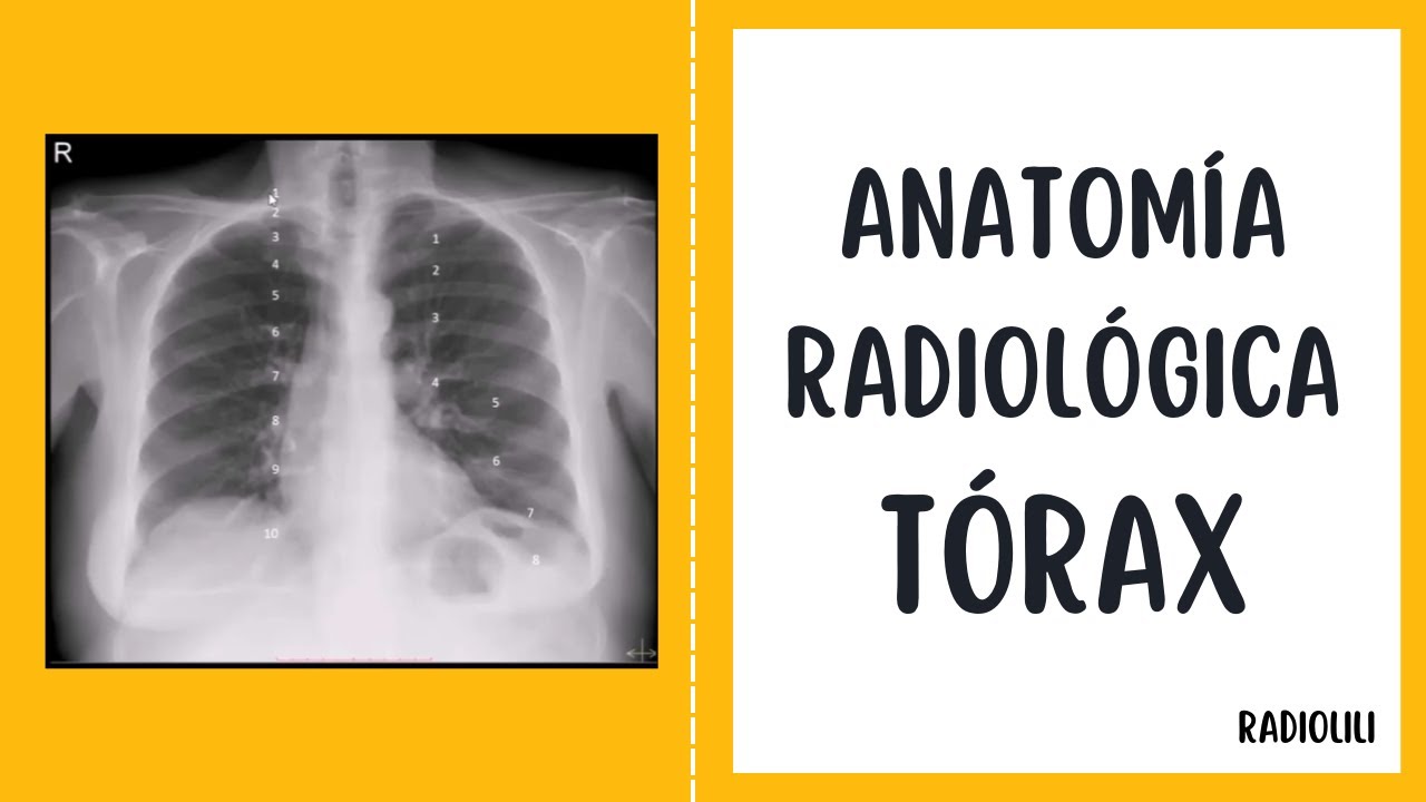 Anatomía Radiológica - Radiología Convencional: Tórax. - YouTube