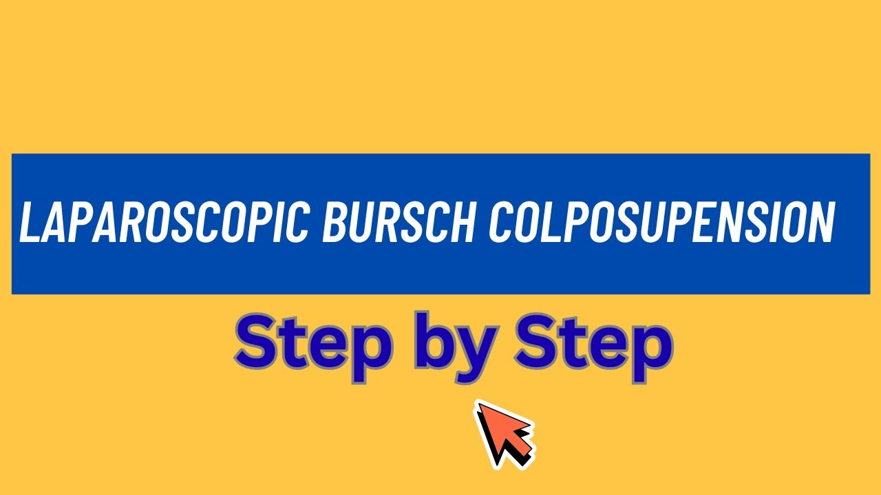Laparoscopic Burch Colposuspension: Step-by-Step Surgical Guide. - YouTube