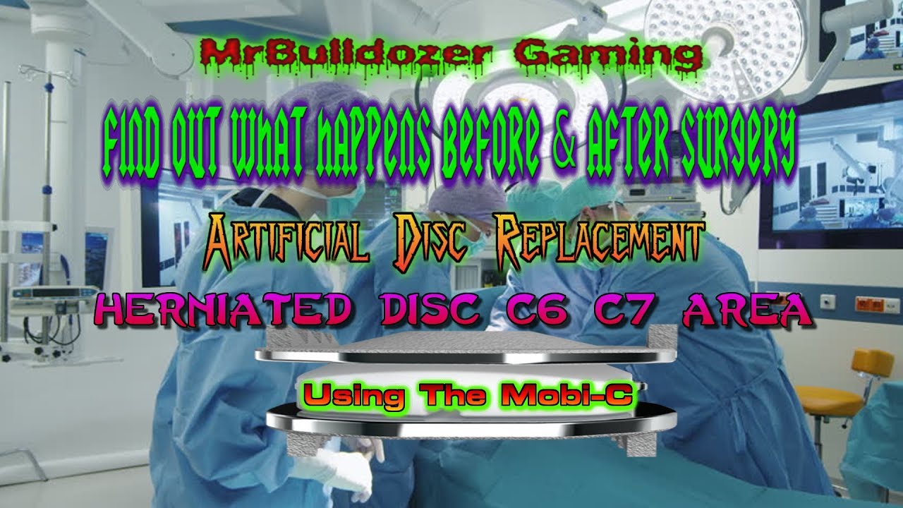 Artificial Disc Replacement Surgery Using The MOBI C Find Out What ...