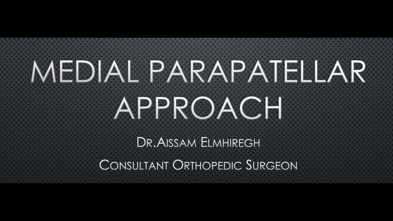 Medial Parapatellar approach HD 720p - YouTube