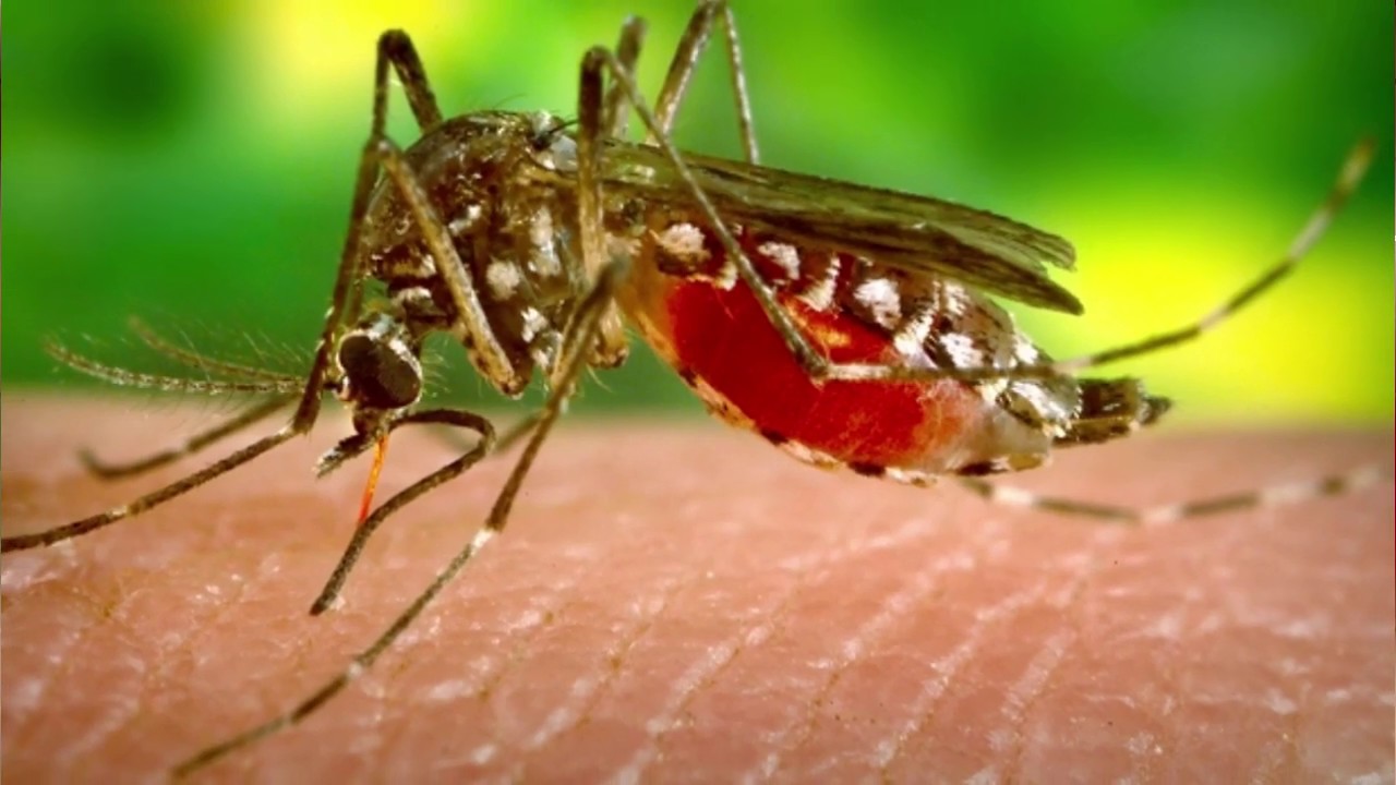 Carbuncles, Cysts & Surgery - Best of the Emergency Room - YouTube