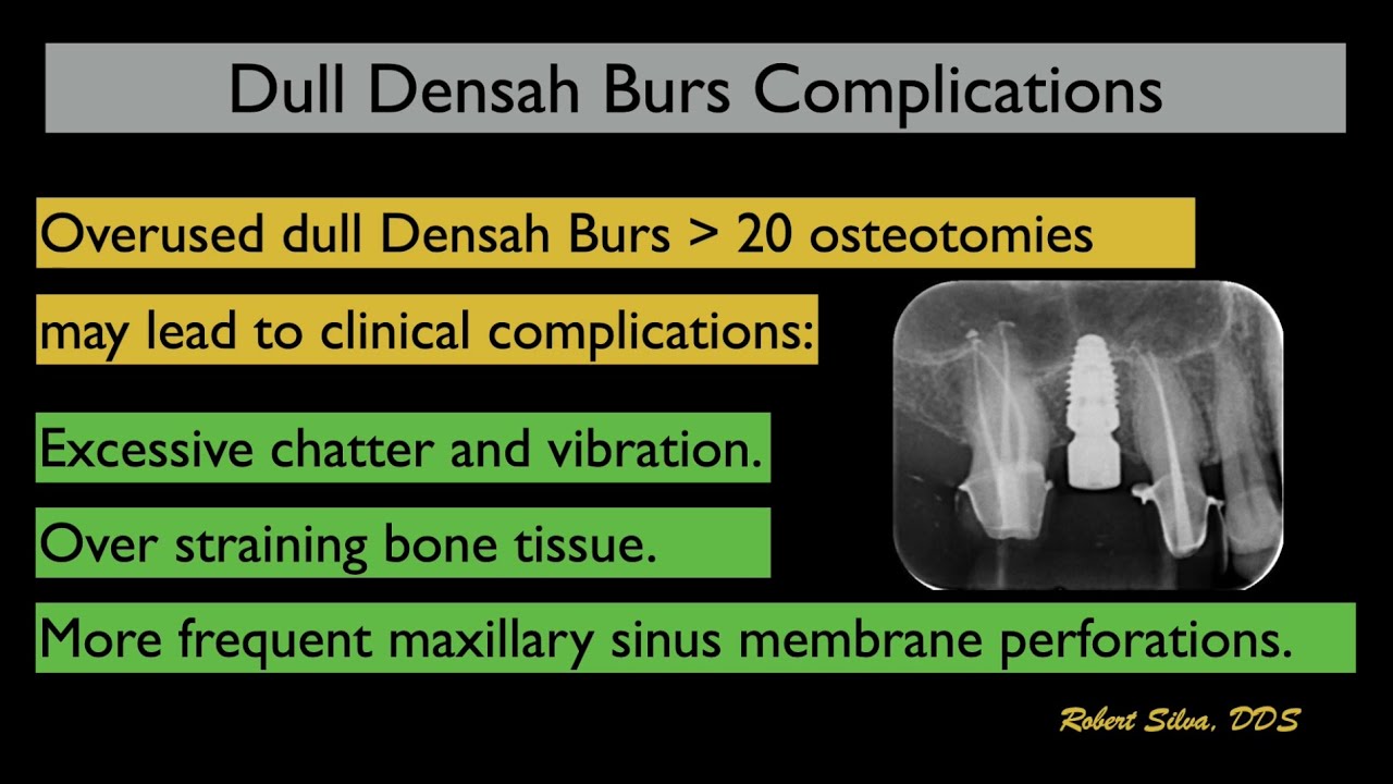 Dull Overused Versah® Densah® Burs complications - YouTube