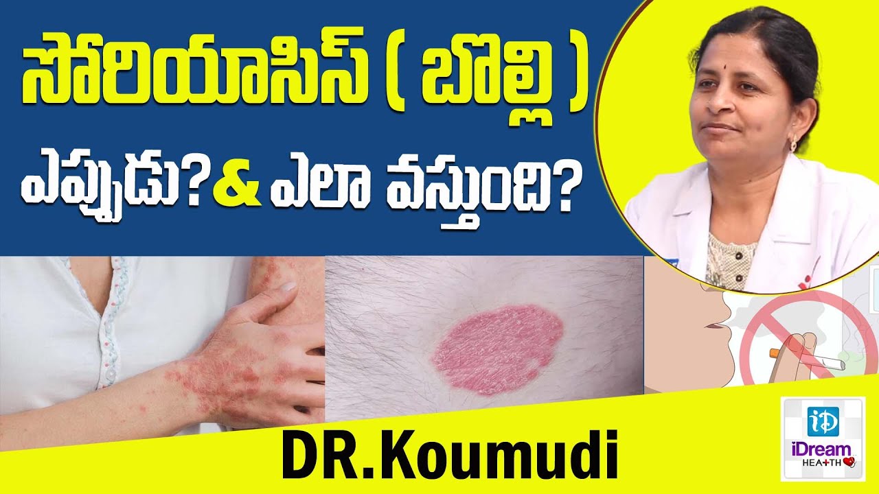 Psoriasis Causes And Symptoms In Telugu Skin Disease Solution In psoriasis-causes-and-symptoms-in-telugu-skin-disease-solution-in