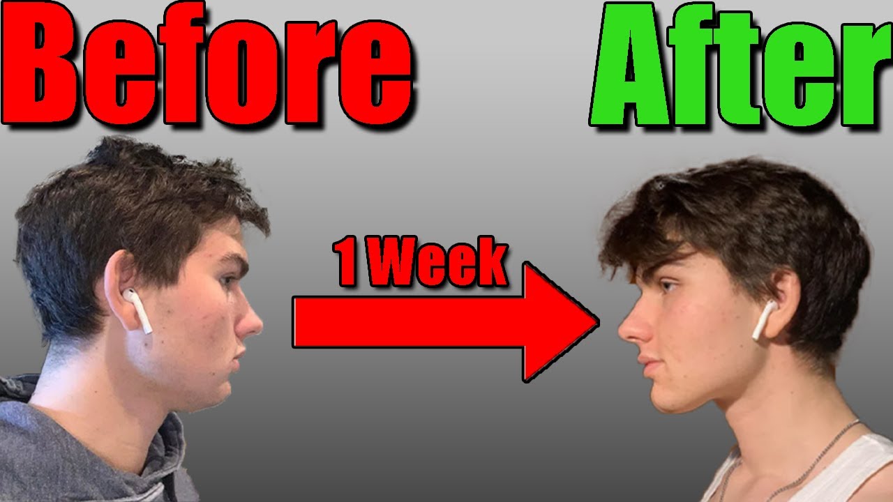 What Is MEWING? How To Improve Your Facial Structure. - YouTube